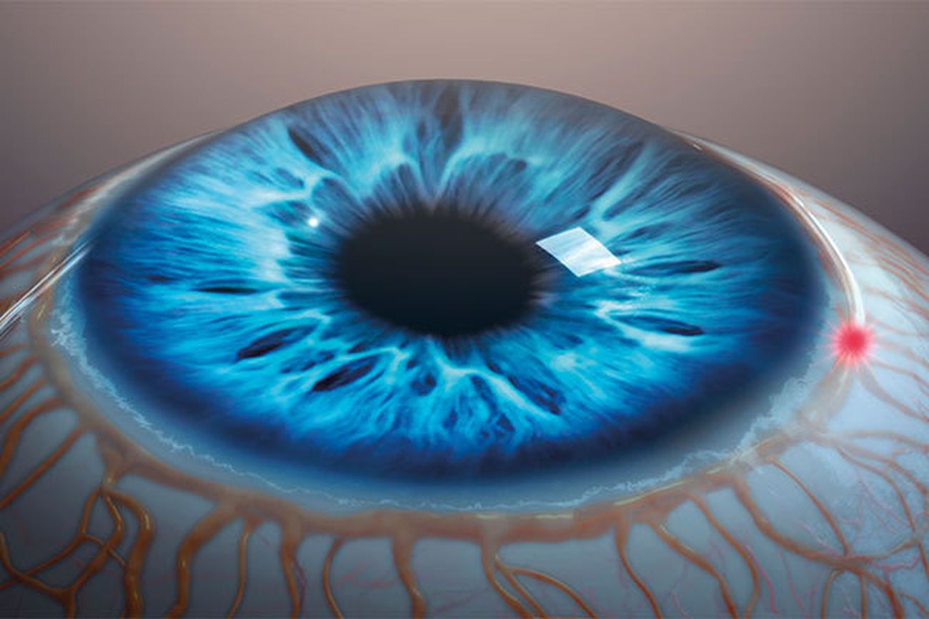 iTrack™ Surgical System from Nova Eye Medical